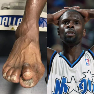 Behold: These Are Lebron's Feet | Courtside Scribbles